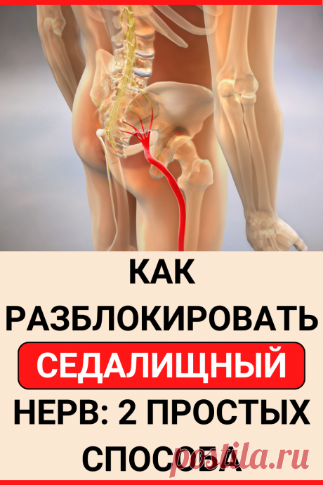 Седалищный нерв