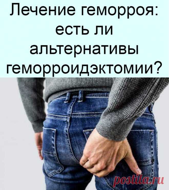 Лечение геморроя: есть ли альтернативы геморроидэктомии? | Полезные ...