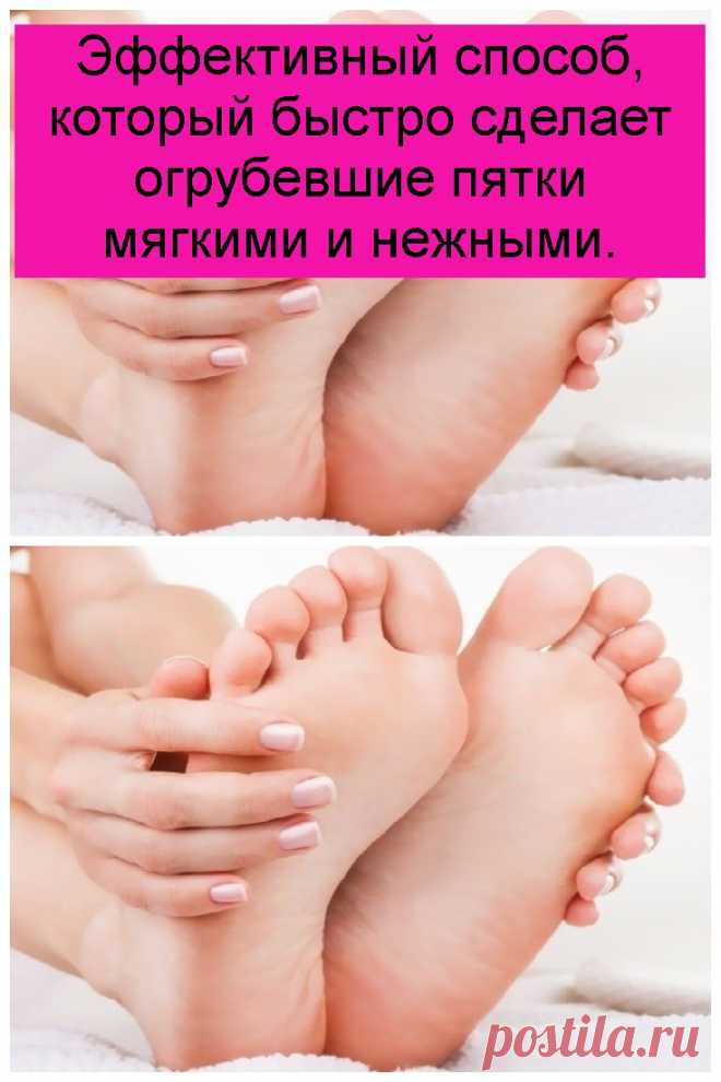 Эффективный способ, который быстро сделает огрубевшие пятки мягкими ...